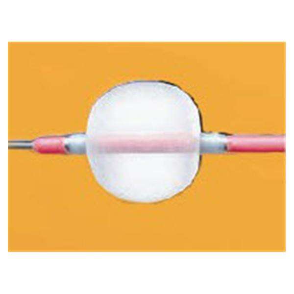 Catheter Embolectomy Fogarty Arterial Thru-Lumen Balloon Thru-Lumen 5 ...